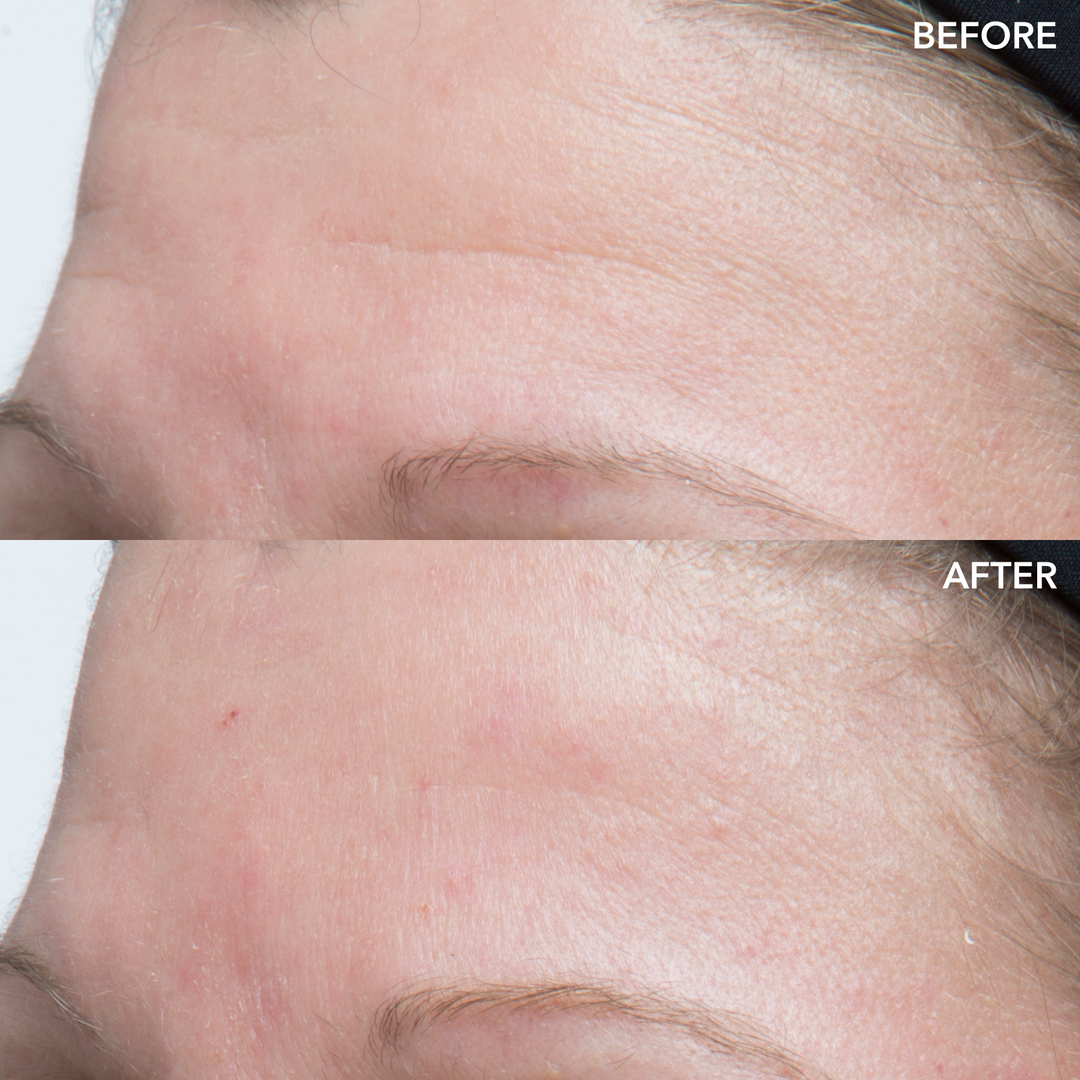 GENIUS Ultimate Anti-Aging Cream – Firm, Smooth & Radiant Skin