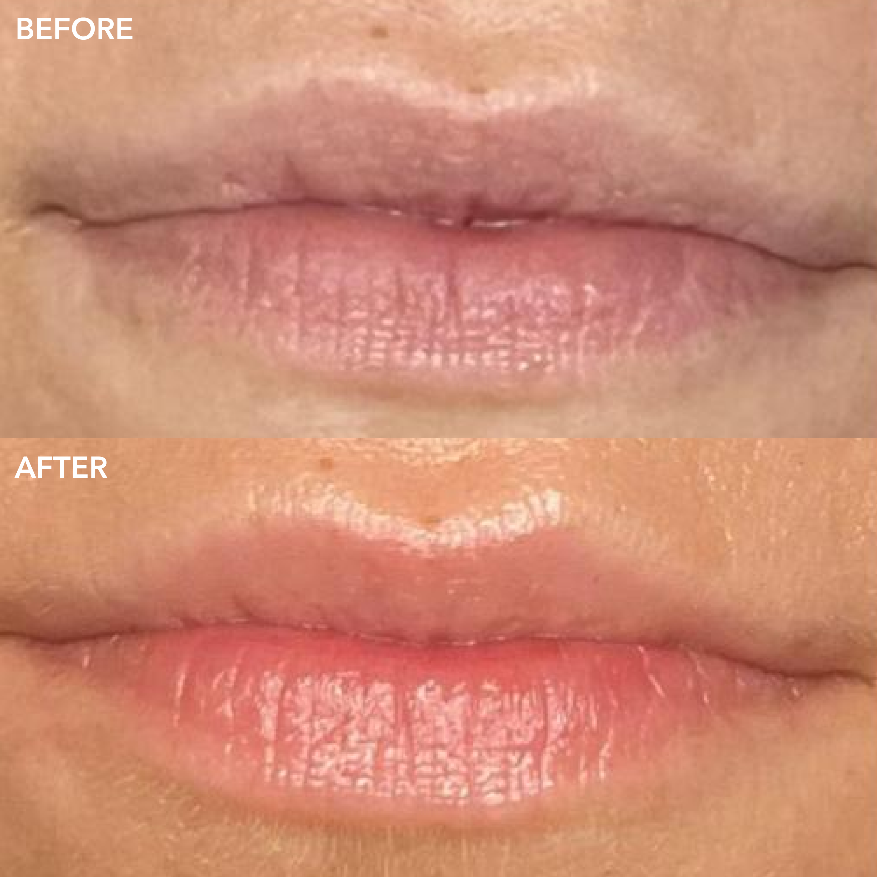 GENIUS Liquid Collagen® Lip | Plump & Smooth Lips