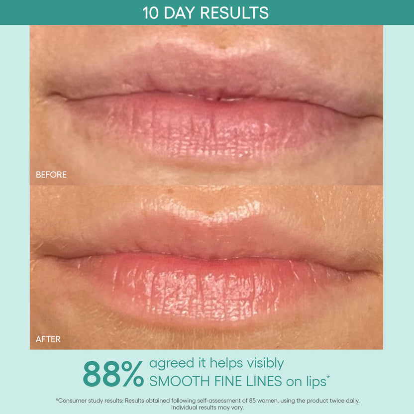 GENIUS Liquid Collagen® Lip | Plump & Smooth Lips – Algenist