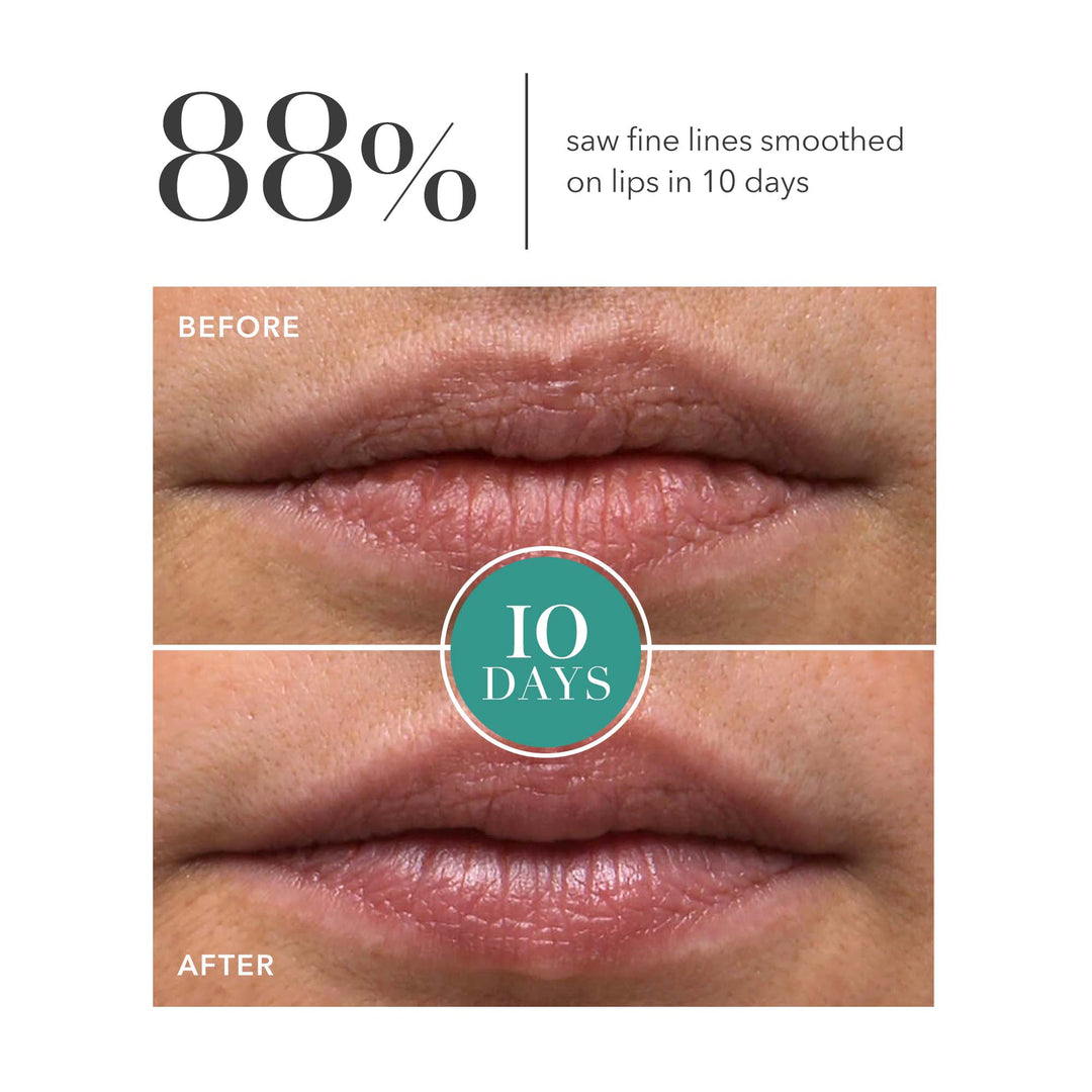 GENIUS Liquid Collagen® Lip