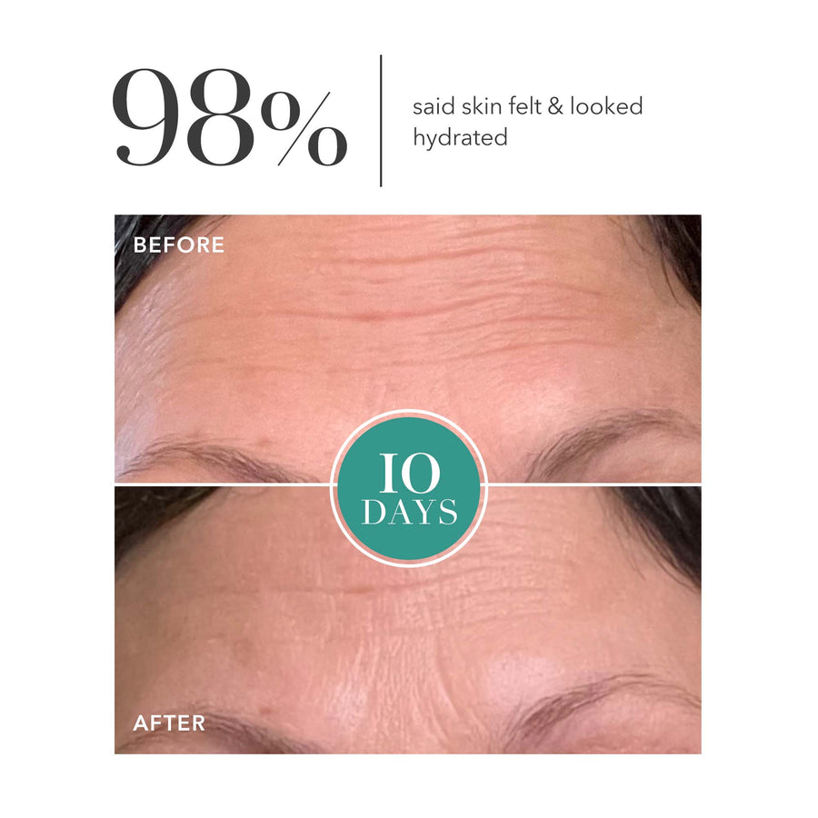 GENIUS Ultimate Anti-Aging Cream | Algenist®