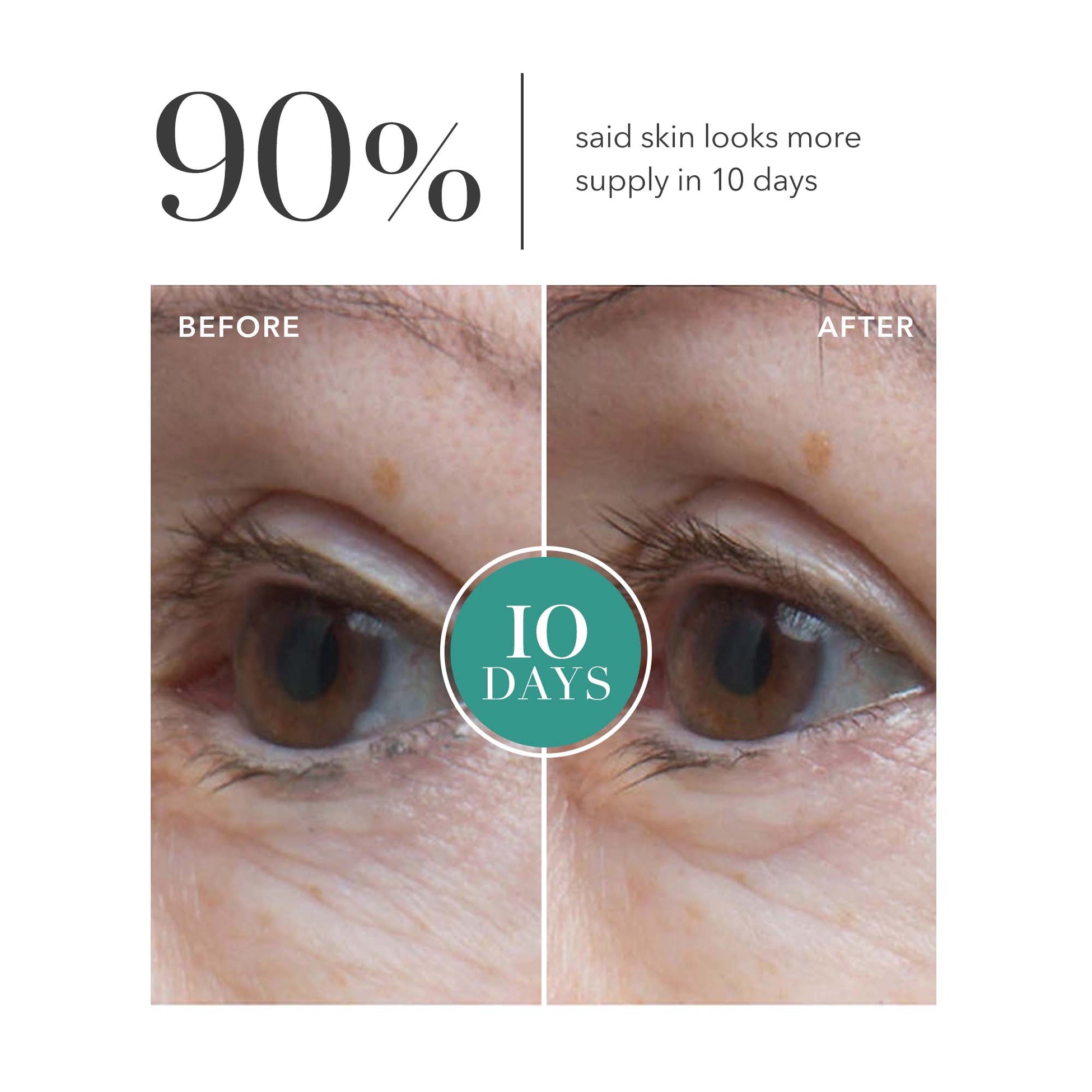 GENIUS Ultimate Anti-Aging Cream | Algenist®